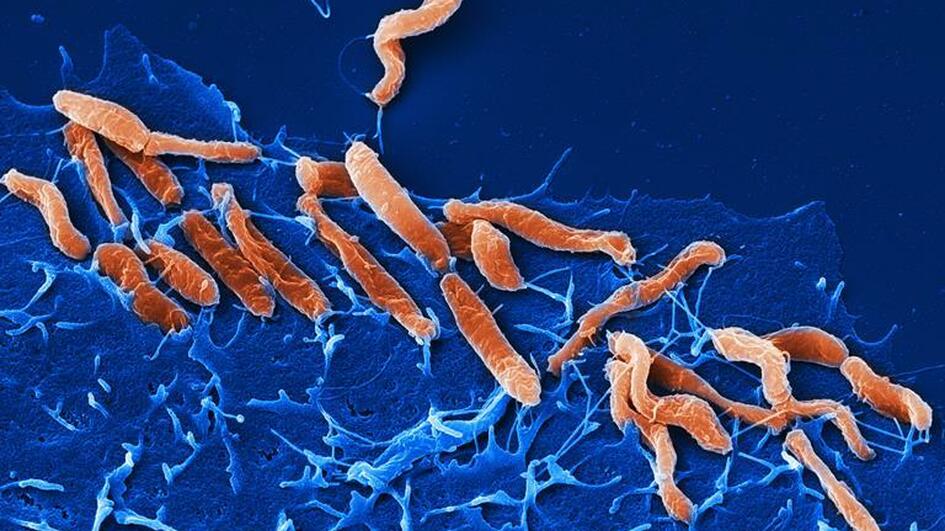 Bakterium Helicobacter pylori: Evolution im Magen | Deutsches Zentrum ...